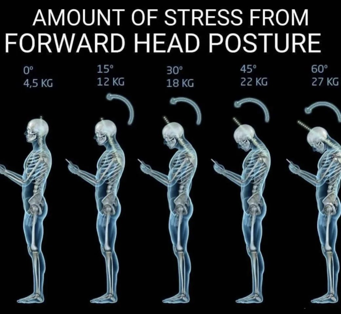 Stress from head posture - theblackairbender