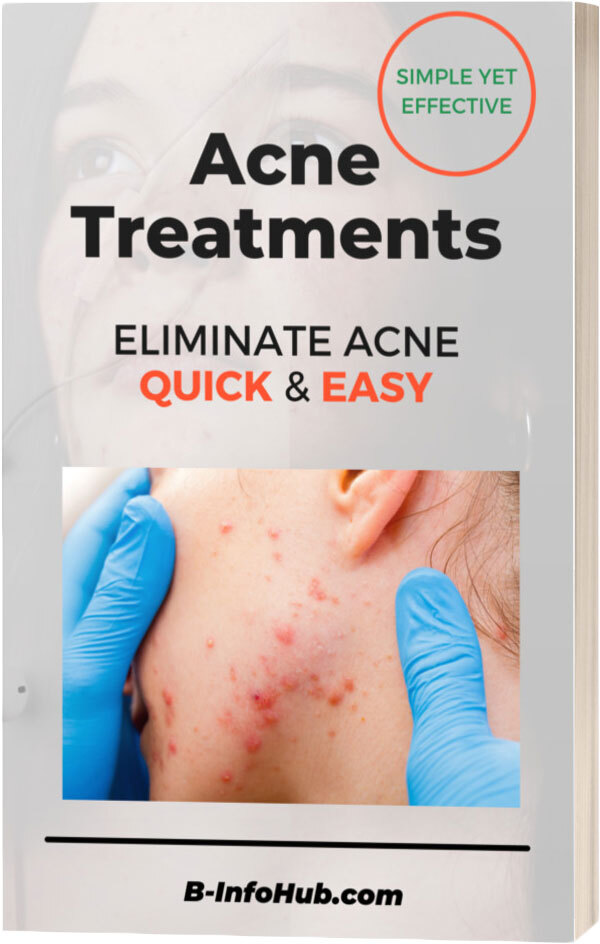 Acne Treatments - Eliminate Acne Quick & Easy