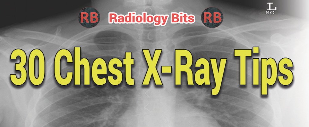 Radiology Bits Course: 30 Chest X-Ray Tips (24/12/2016)