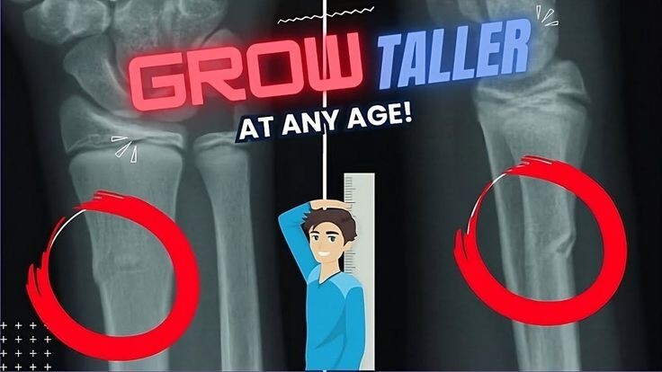 AURACHAD - Advanced Height Maxxing Program