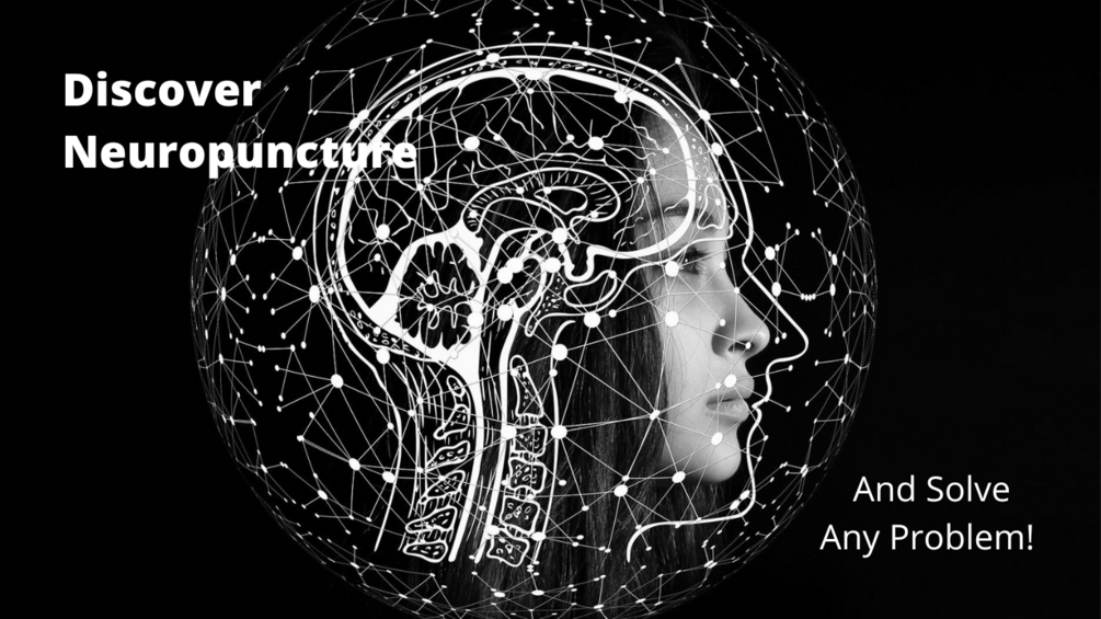 Get Rid of Any Problem With Neuropuncture!