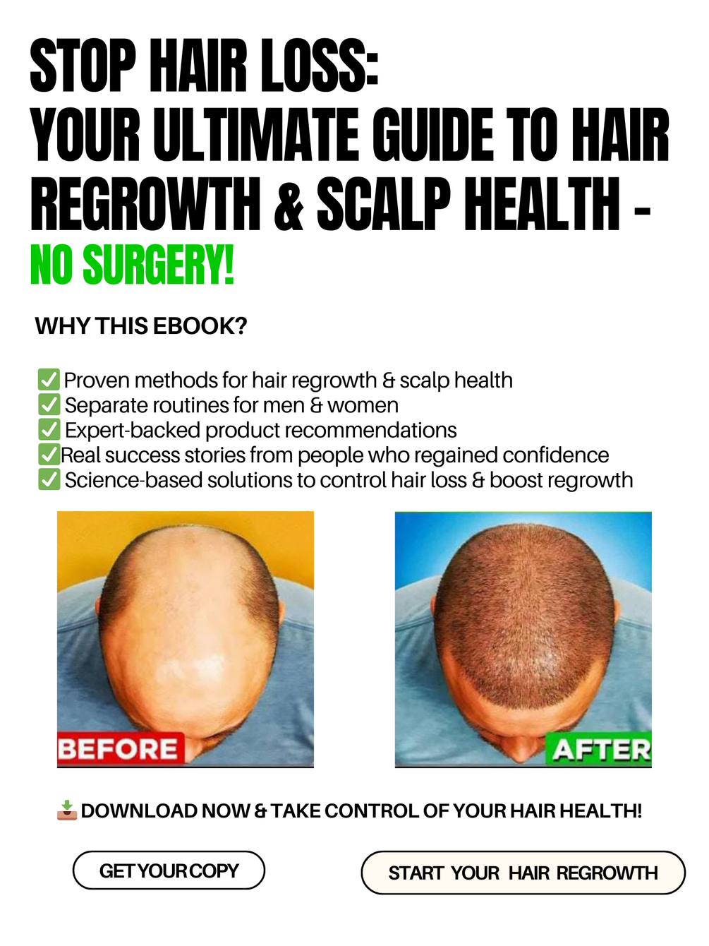 Stop Hair Loss Today: The Ultimate Step-by-Step Guide for Regrowing Hair and Restoring Scalp ...