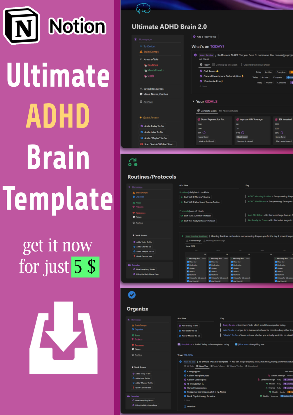 Ultimate ADHD Brain Template – Boost Focus & Productivity Effortlessly!