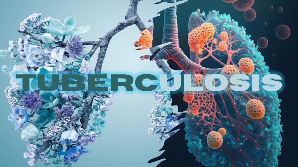 Tuberculosis ppt