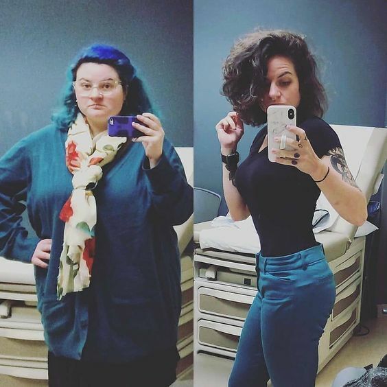 Keto Body Trim