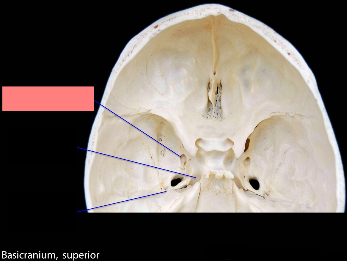 🧠 MRCS Part B Cadaver Anatomy with Annotations (Based on Previous ...