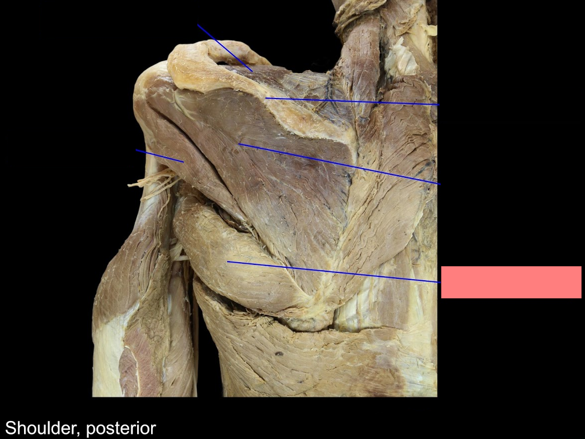 🧠 MRCS Part B Cadaver Anatomy with Annotations (Based on Previous ...