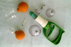 Beginner's Guide to Cupping