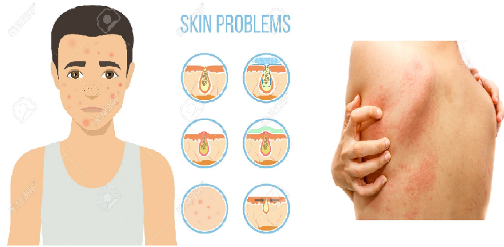 For Skin Problem