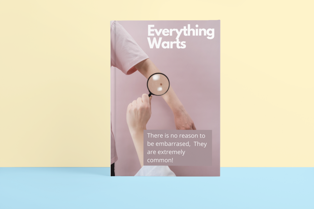 Warts! There is no need to be Embarrassed!