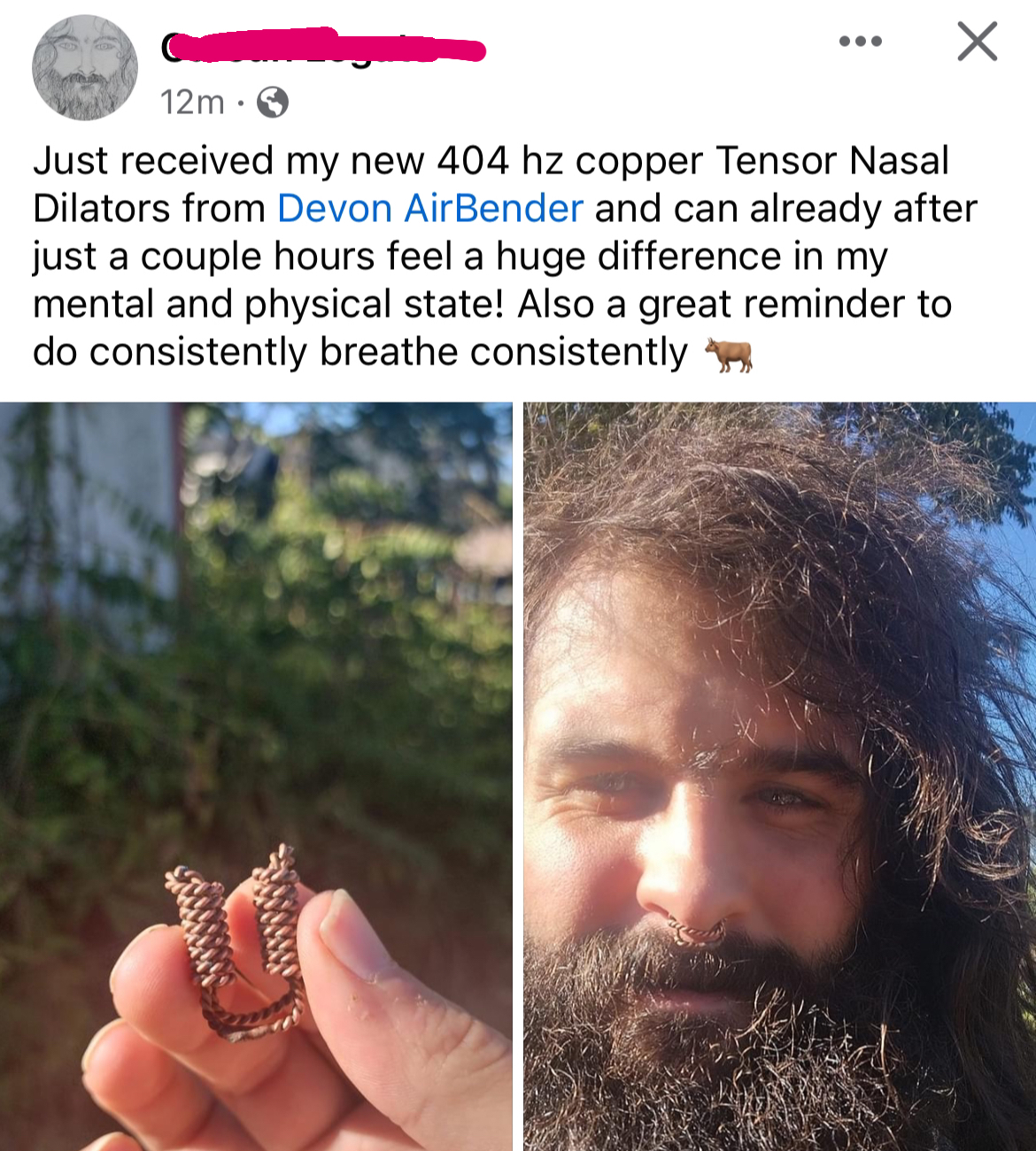 Copper Tensor Dilator testimonial - theblackairbender