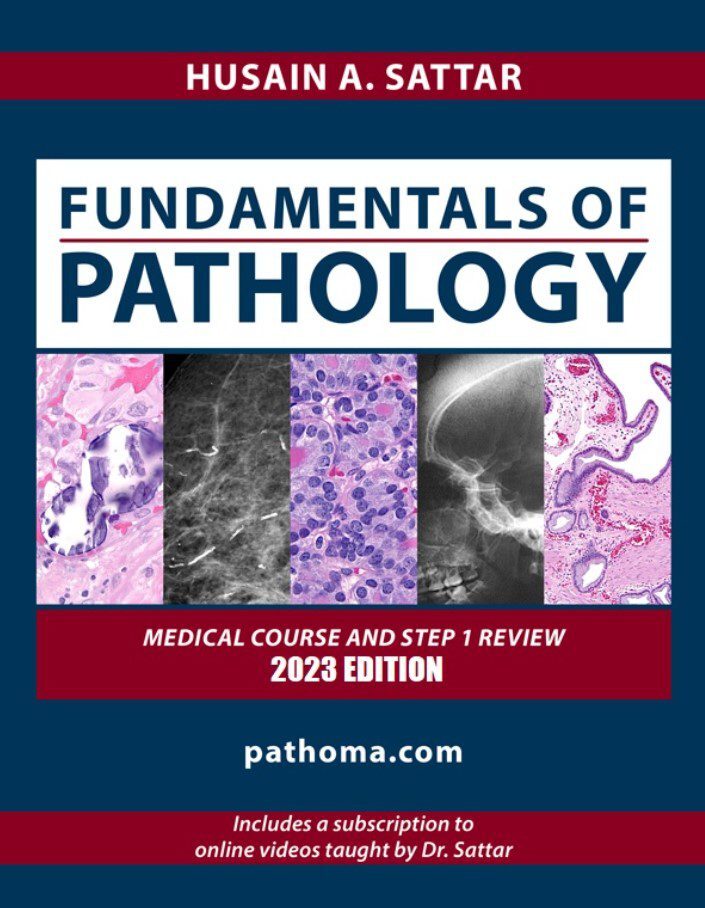 VASCULAR PATHOLOGY MCQS( FROM PATHOMA)