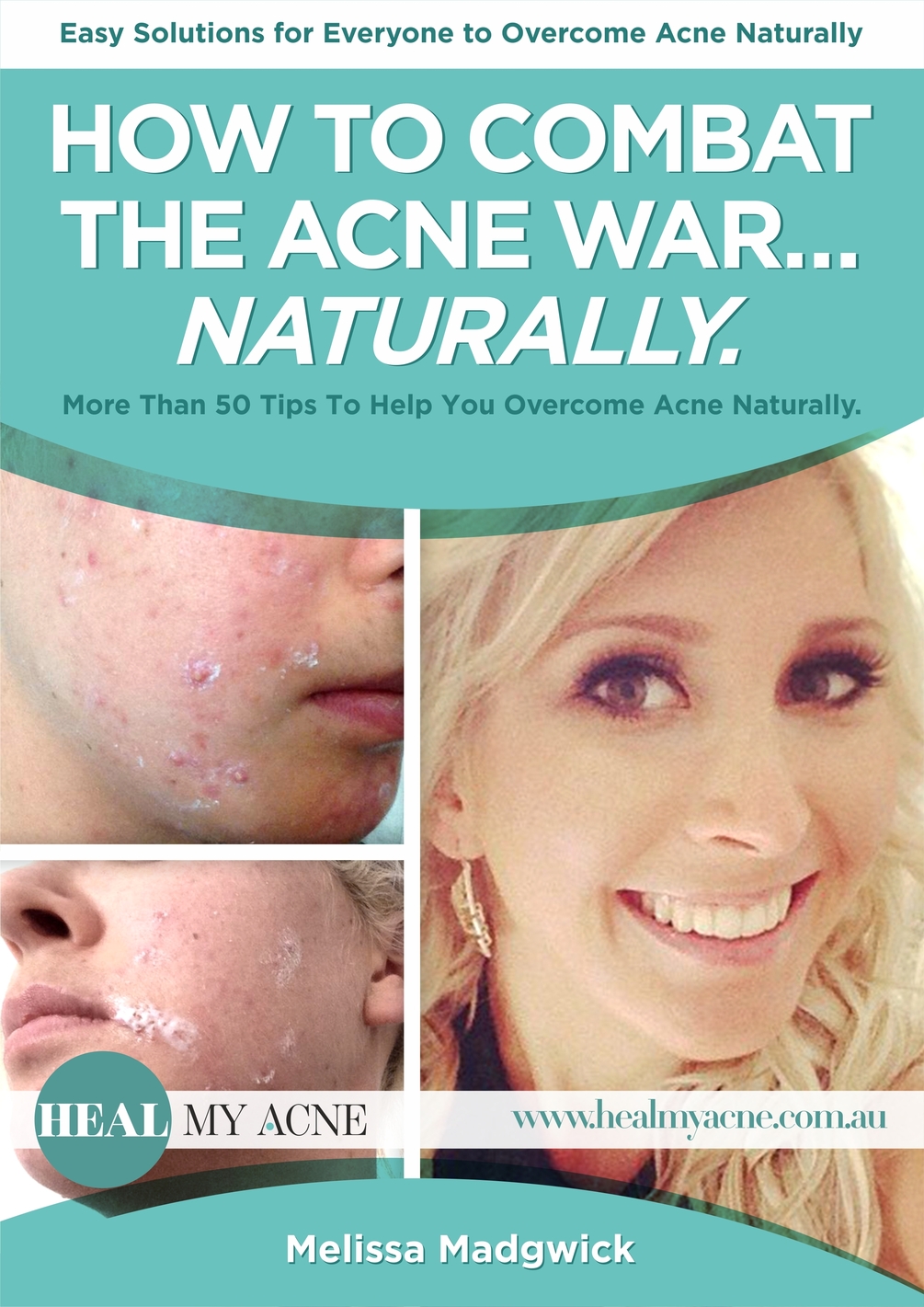 Heal My Acne Book