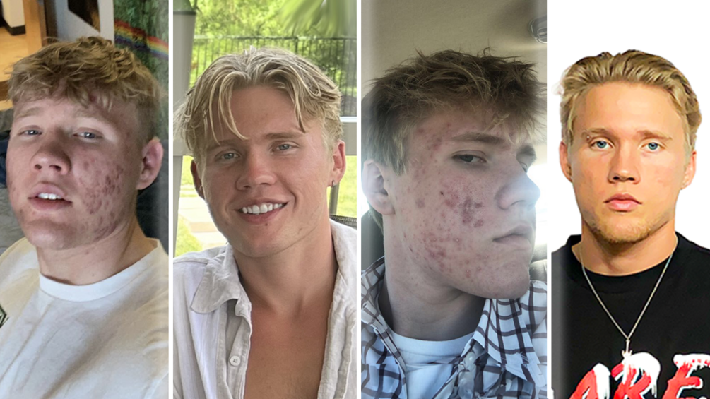 Transform Your Skin: The Ultimate Guide