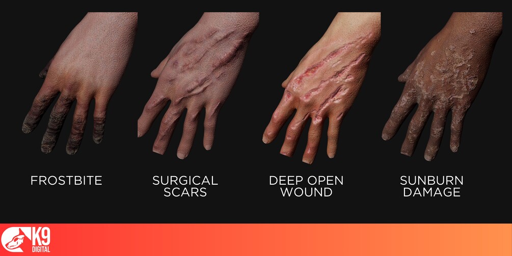 PBR Skin Trauma / Weathering - Smart Materials