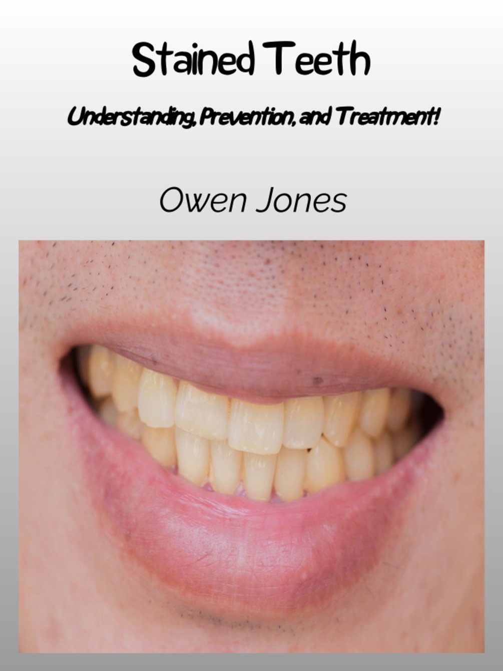 Stained Teeth - Understanding, Prevention, and Treatment!