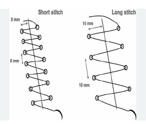 Stitch ratio