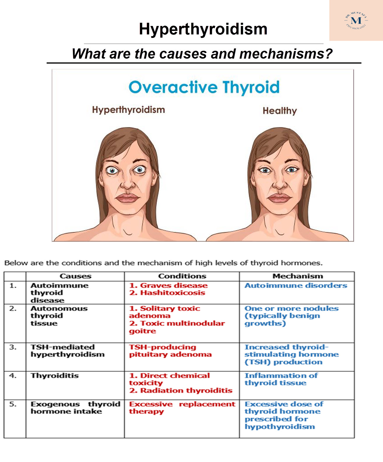 Hyperthyroidism: Causes and Mechanisms - Mustafa