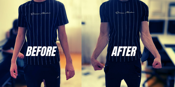 🦾 10-Weeks Forearm Plan