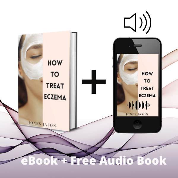 How To Treat Eczema (eBook + Free Audio Book)