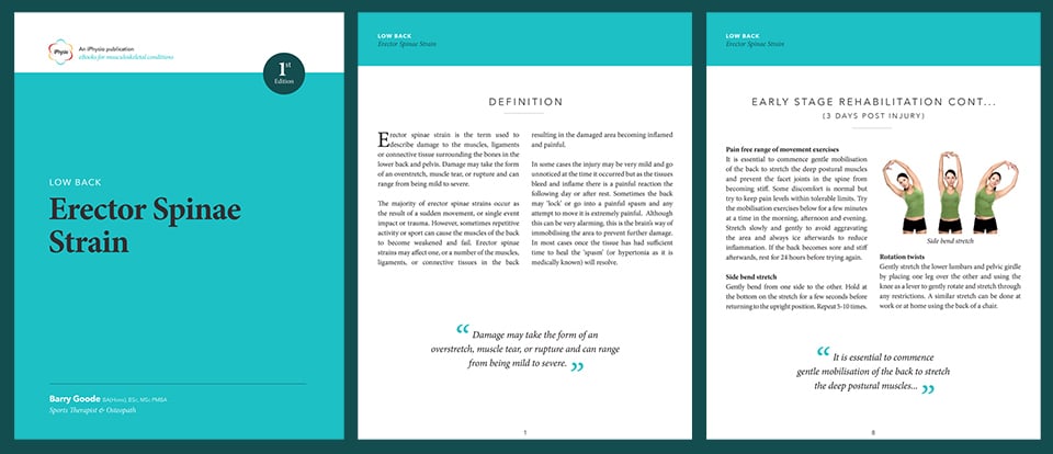 Erector Spinae Strain (Low Back) treatment guide