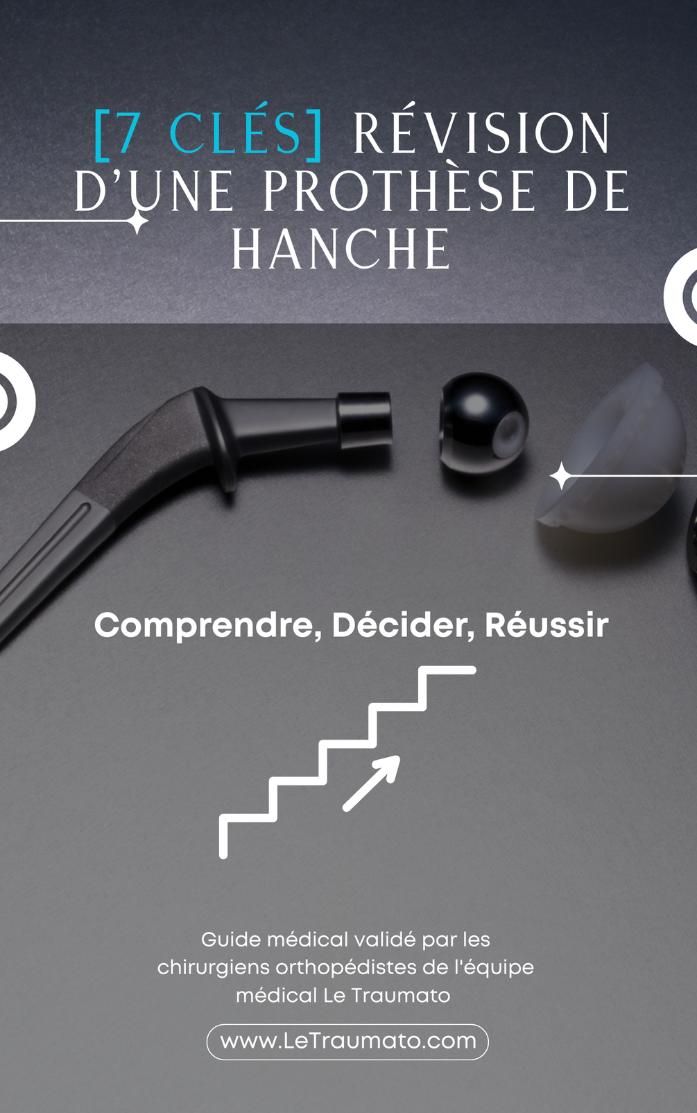 Révision d’une prothèse de hanche : comprendre, décider, réussir