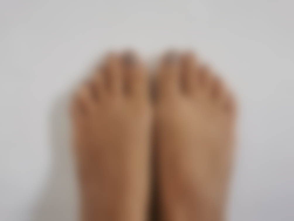 My greek flat feet starter pack