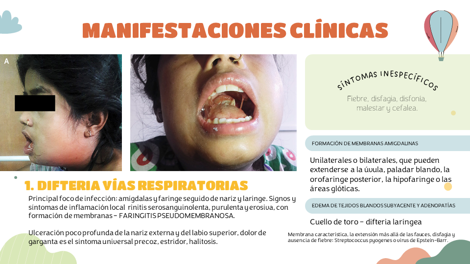 Pediatría: Tétanos y Difteria