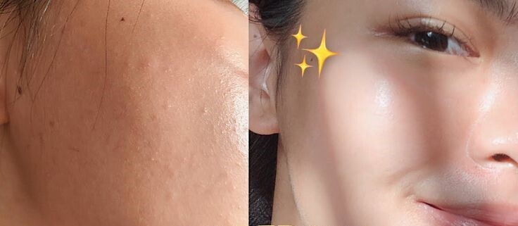 30 days glass skin routine - for all types of skin specified