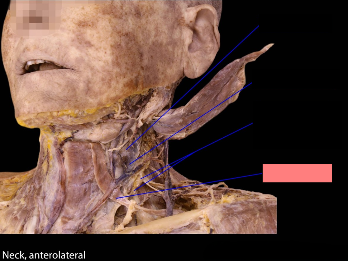 🧠 MRCS Part B Cadaver Anatomy with Annotations (Based on Previous ...