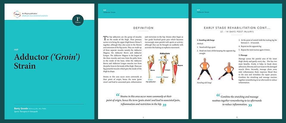 Adductor/Groin Strain (Hip) treatment guide