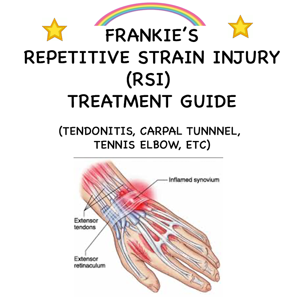 RSI Treatment Guide