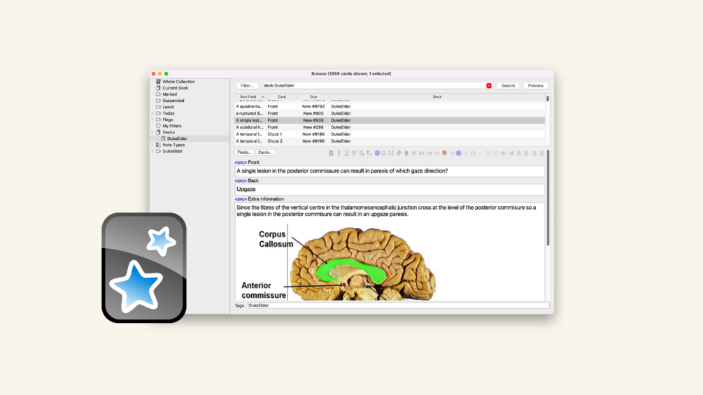 Duke Elder Anki Deck