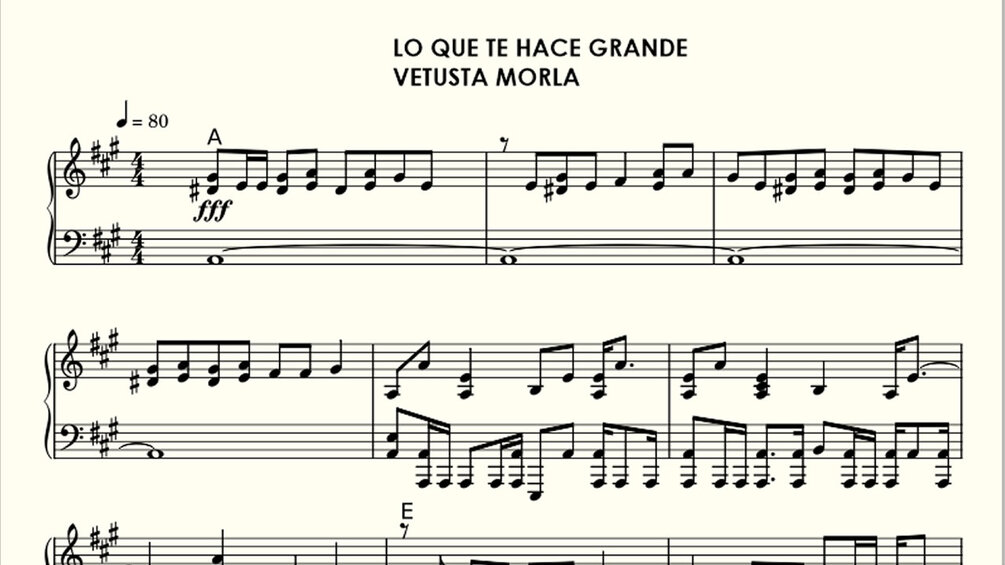 Vetusta Morla - Lo que te hace grande