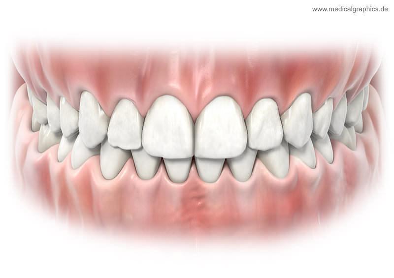 Illustration Zähne von vorne / Teeth from the front