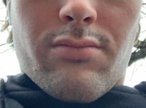 Guide to improve facial structure (Look better, Feel better)