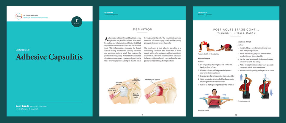 Adhesive Capsulitis (Shoulder) treatment guide