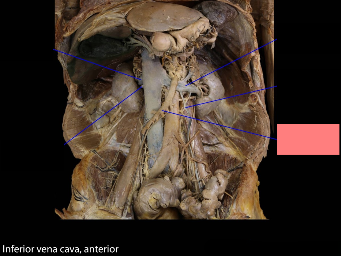 🧠 MRCS Part B Cadaver Anatomy with Annotations (Based on Previous ...