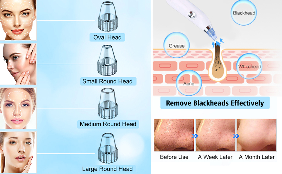 Beauty Explorer's DermaSuction Black Remover